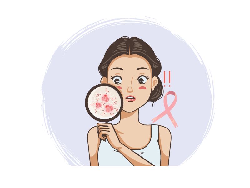 Cancerul de piele - simptome, diagnostic. tratament - Synevo
