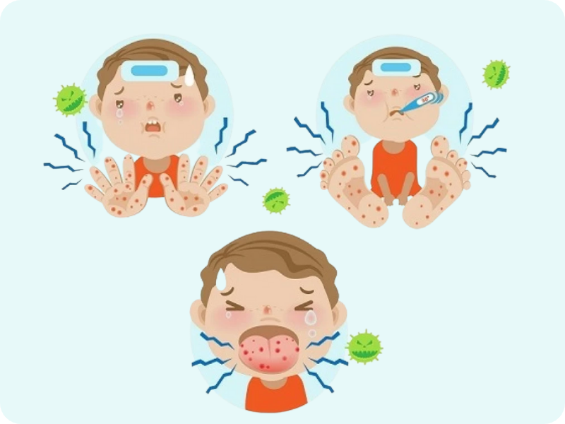 Boala Gura Mana Picior - o afectiune in randul copiilor - Synevo