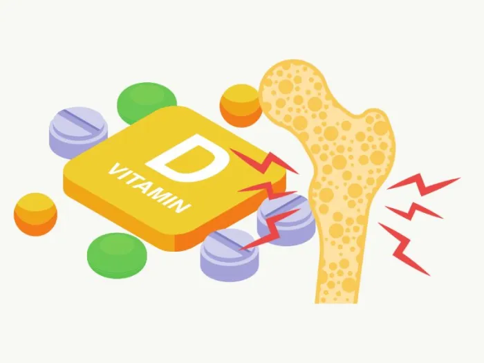 Rahitismul și carența de vitamina D - Synevo