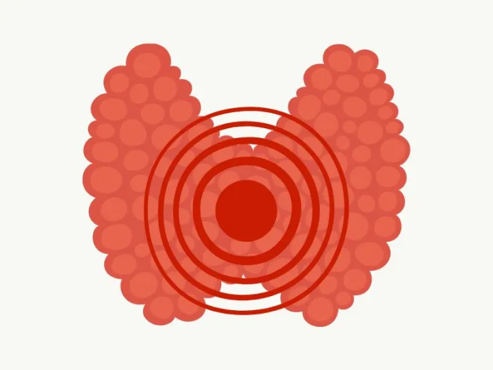 Tiroidita autoimuna Hashimoto - Synevo